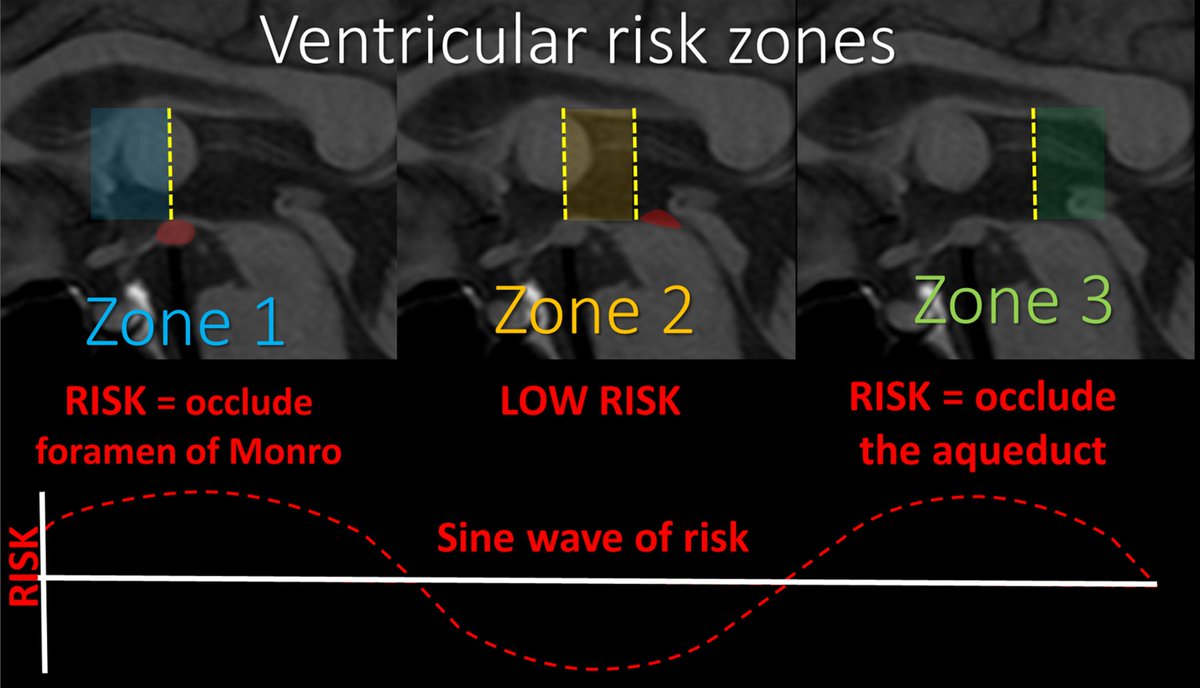 1/Don't fall for the siren song of calling all bright round objects at ...