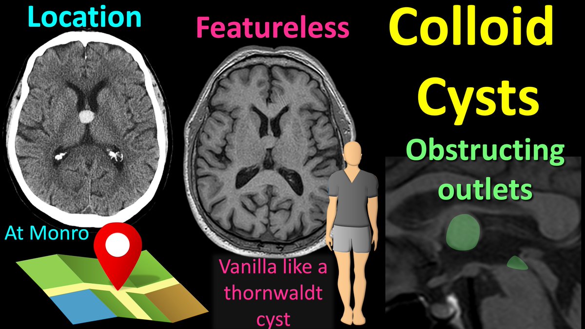 1/Don't fall for the siren song of calling all bright round objects at ...