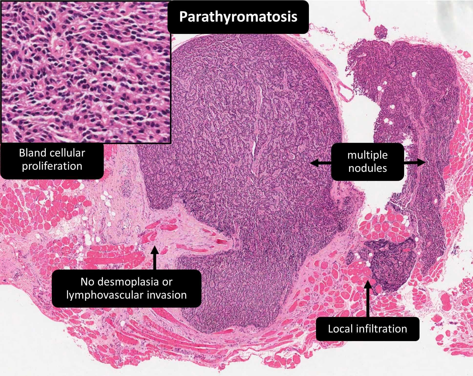Parathyroid Histology Labeled Parathyroid – Normal Histology – NUS