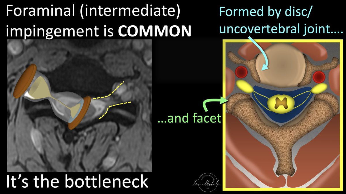 1/Feeling unarmed when it comes to evaluating cervical radiculopathy ...