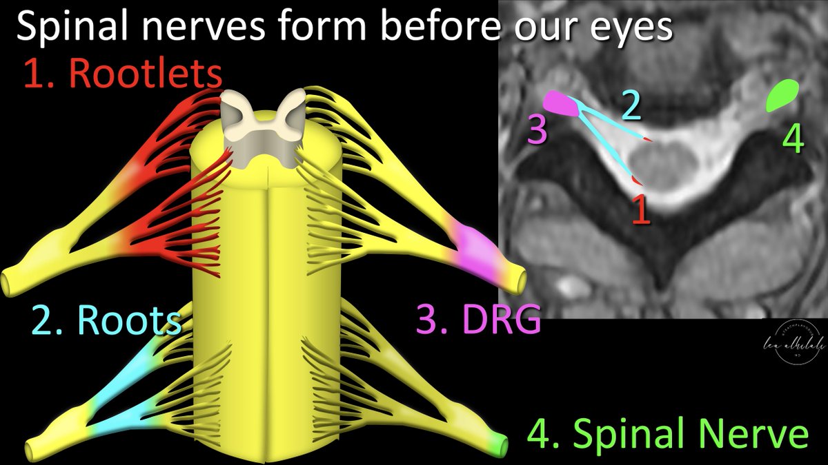 1/Feeling unarmed when it comes to evaluating cervical radiculopathy ...