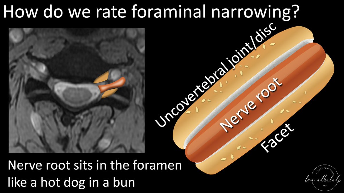 1/Feeling unarmed when it comes to evaluating cervical radiculopathy ...