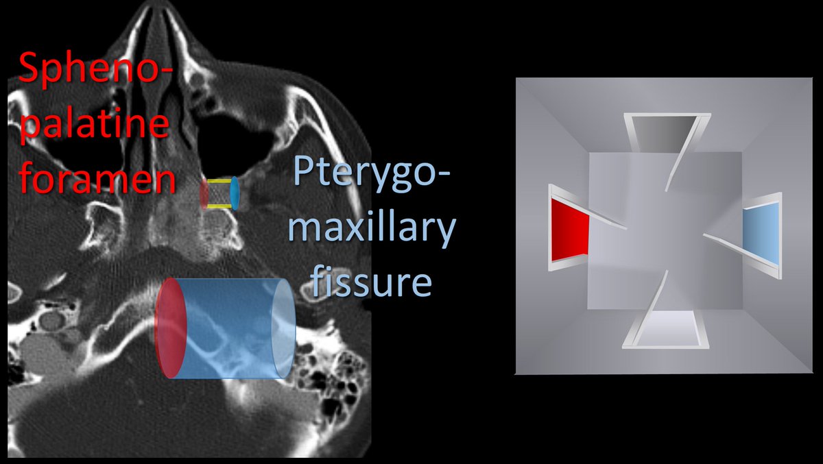 1/Does PTERYGOPALATINE FOSSA anatomy feel as confusing as its spelling ...
