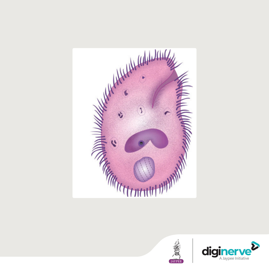 Balantidium Coli Diagram