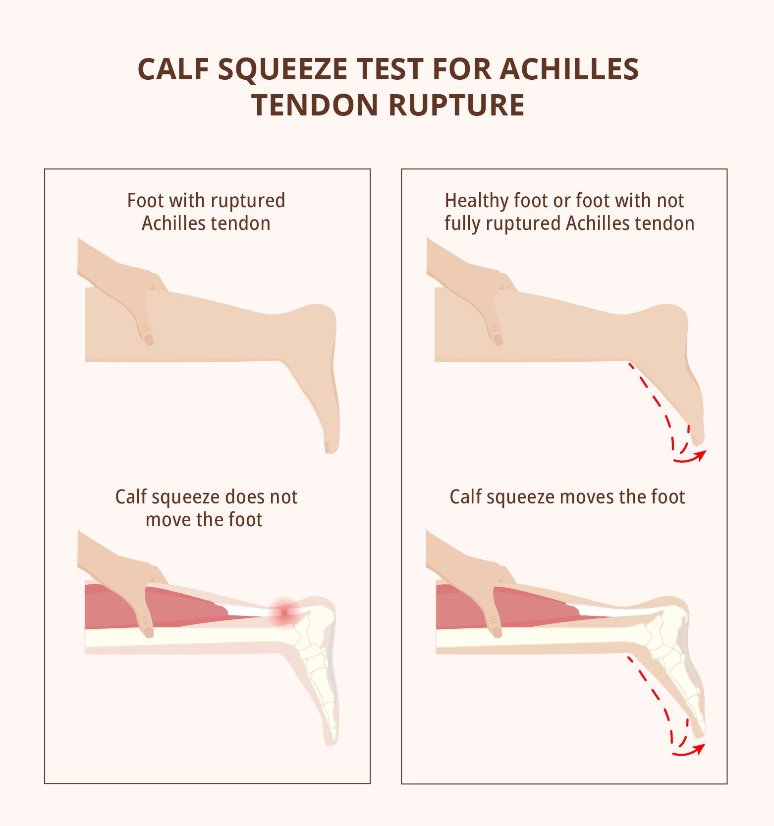 Thompson Test Thompson Test Chart Xpert 3D With AIO PC | Used Test