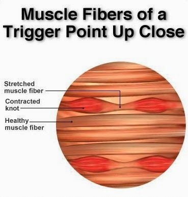 Muscles become tight when they are weak and starved of energy, such as ...