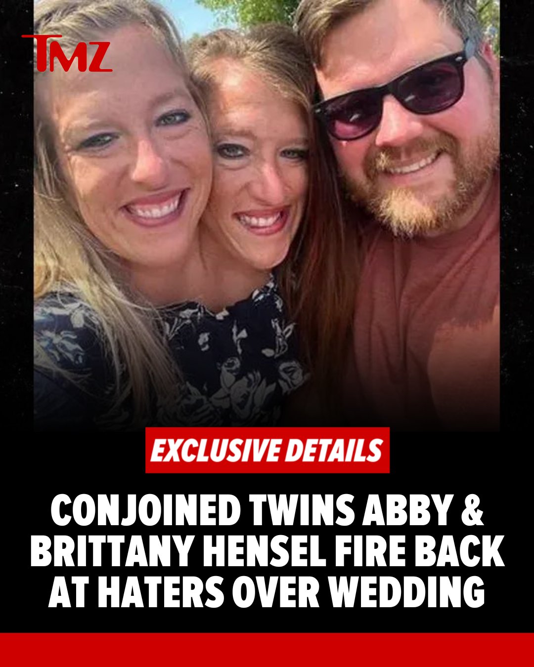 How Conjoined Twins Abby And Brittany Hensel Look Like Conjoined Twin