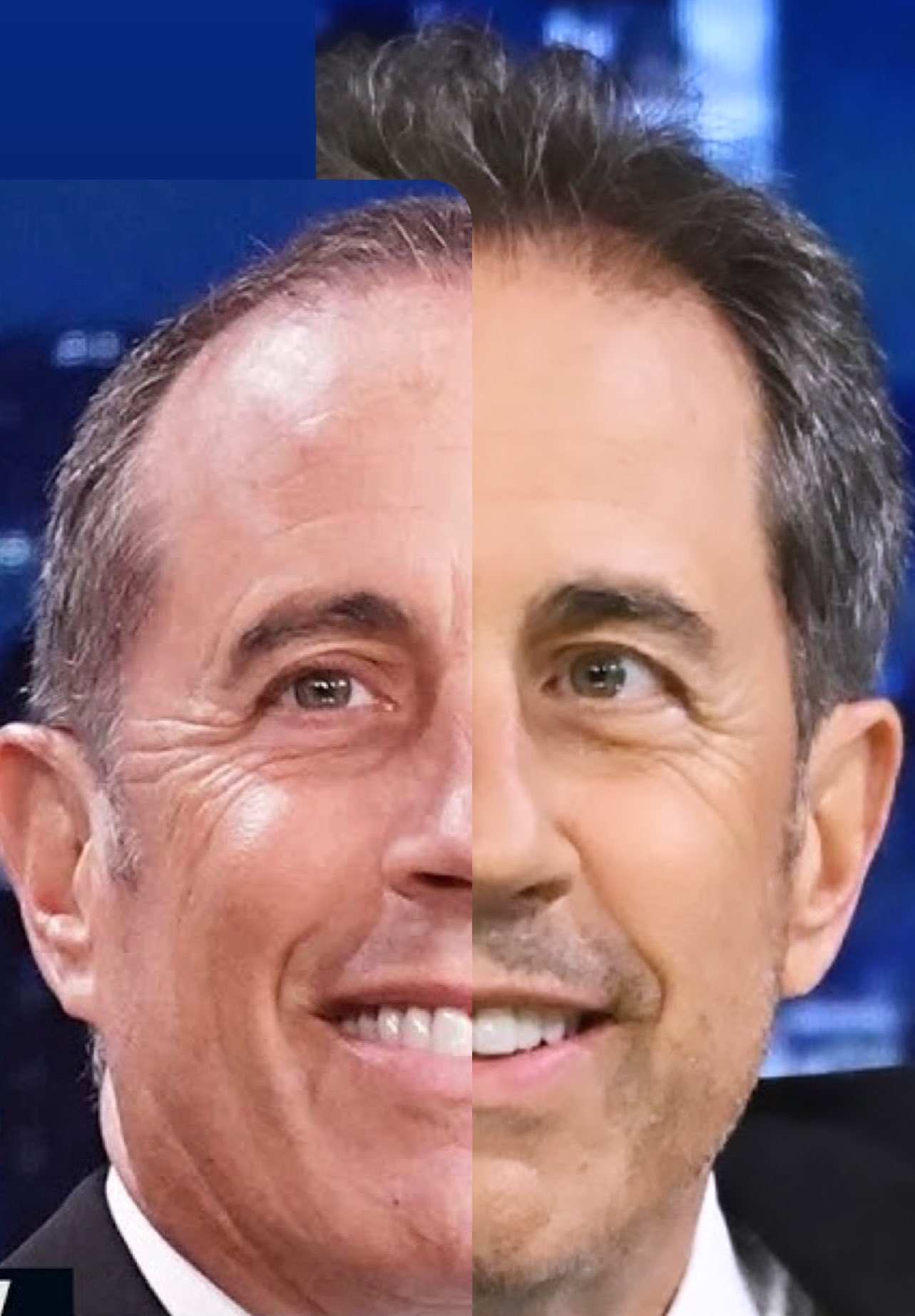 Jerry Seinfeld Haaruitval Join Us In The Laughter Filled Lane As Jerry