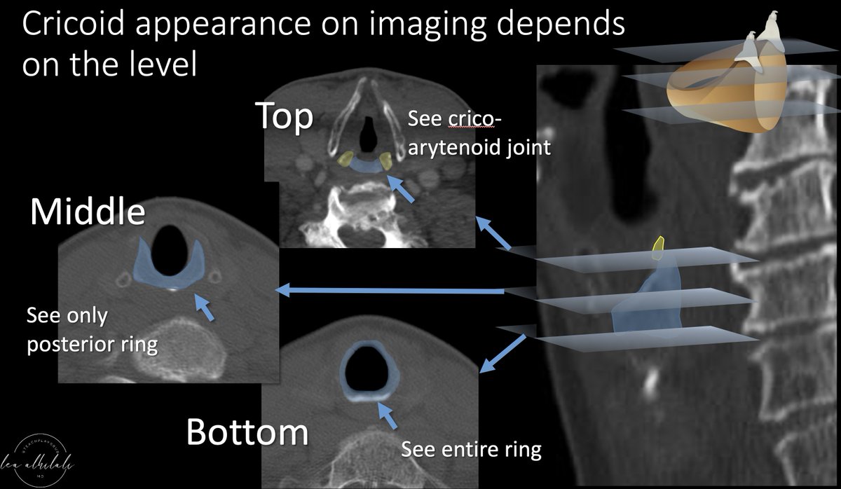 1/Do questions about laryngeal anatomy leave you speechless? Is the ...