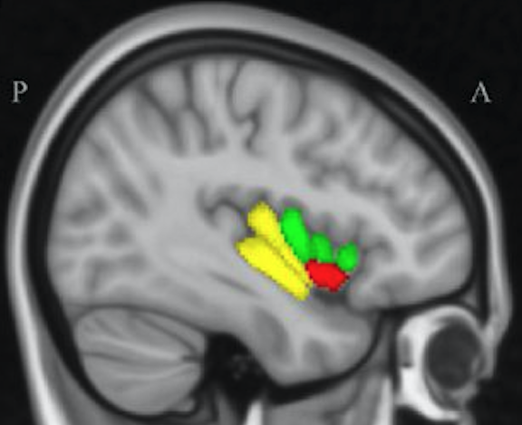 Why is the insula the most interesting region in the brain? Here are 6 ...