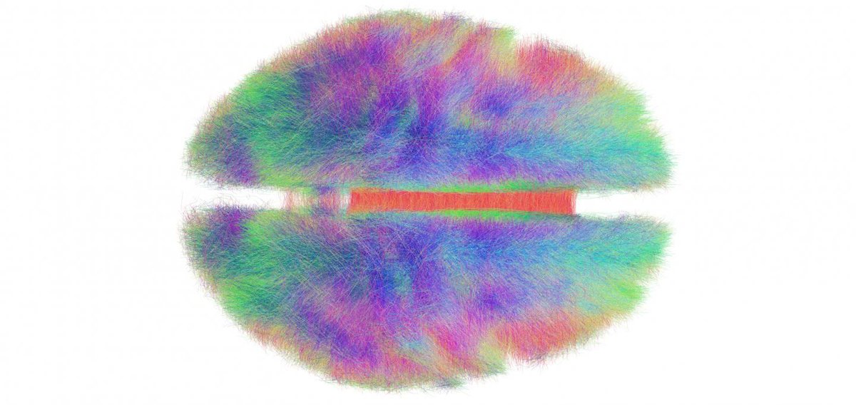 Global Brain Initiatives - Generate Tsumani of #Neuroscience! #BigData ...
