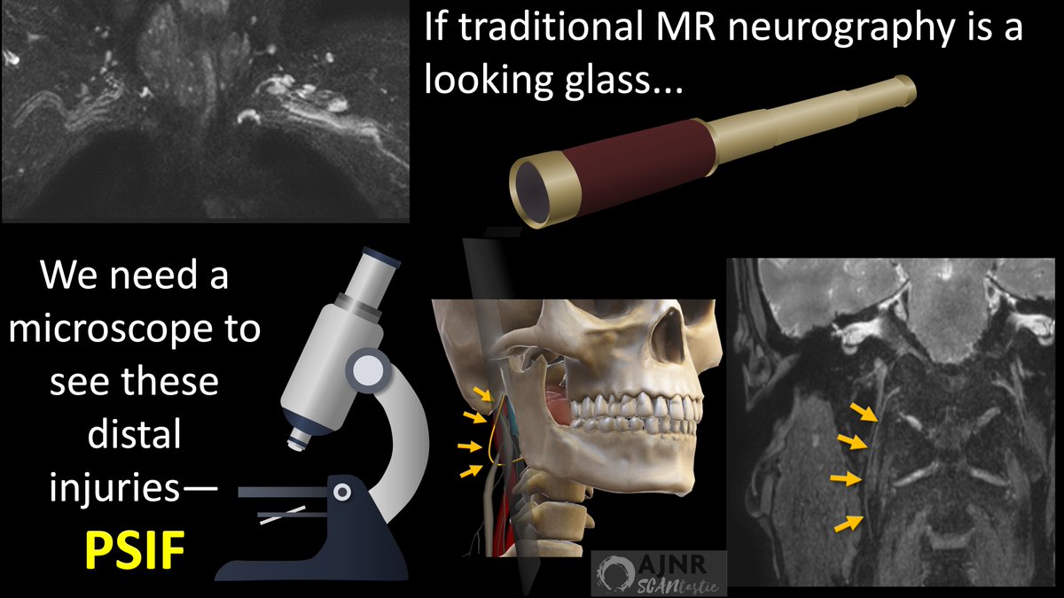 1/Does trying to diagnose trigeminal neuralgia give you a splitting ...