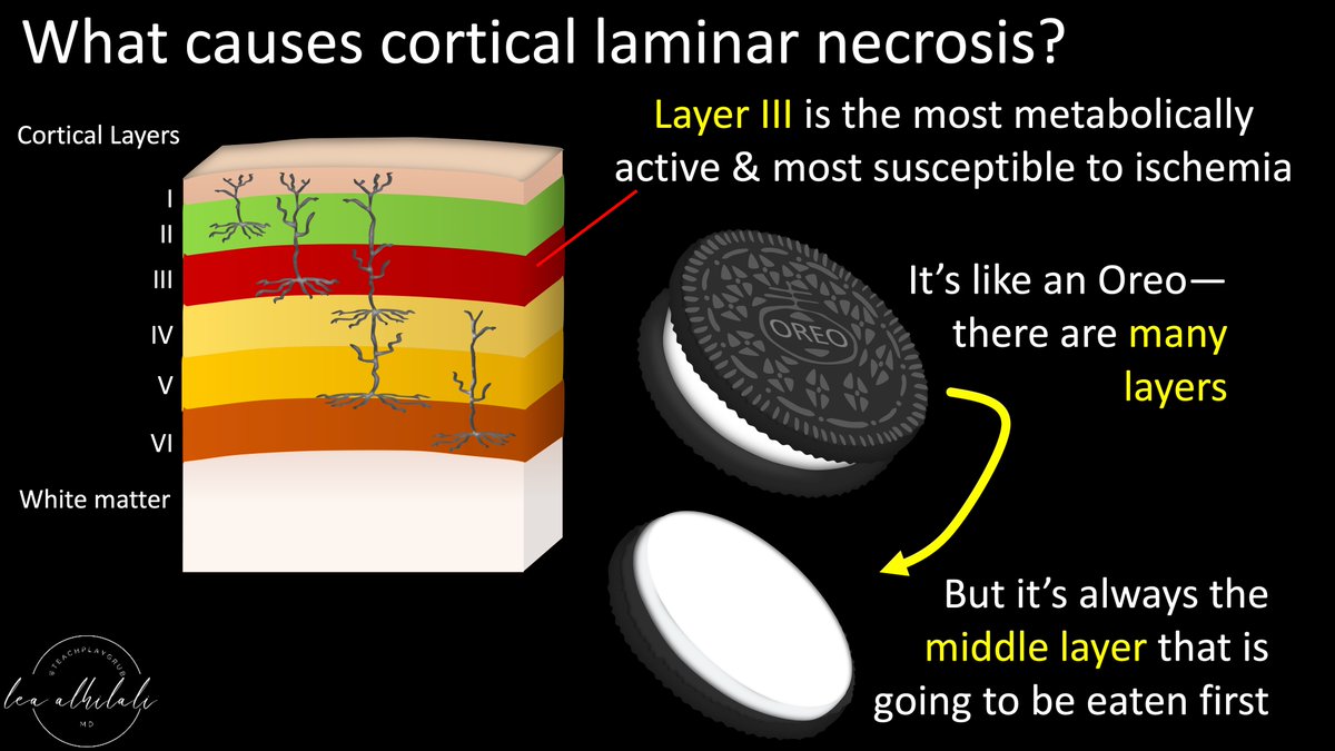 1/Time is brain! But what time is it? If you don’t know the time of ...