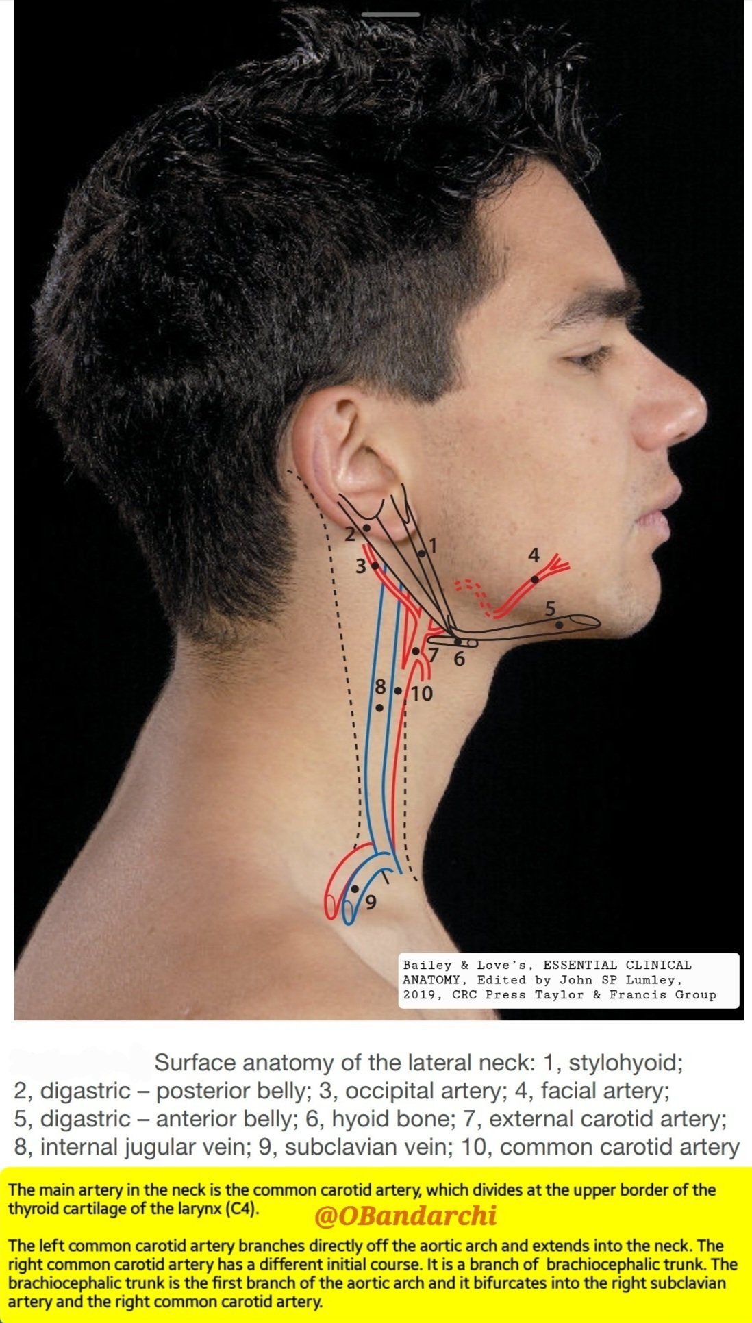 Thyroid Surface Anatomy File:Thyroid System.svg Wikipedia