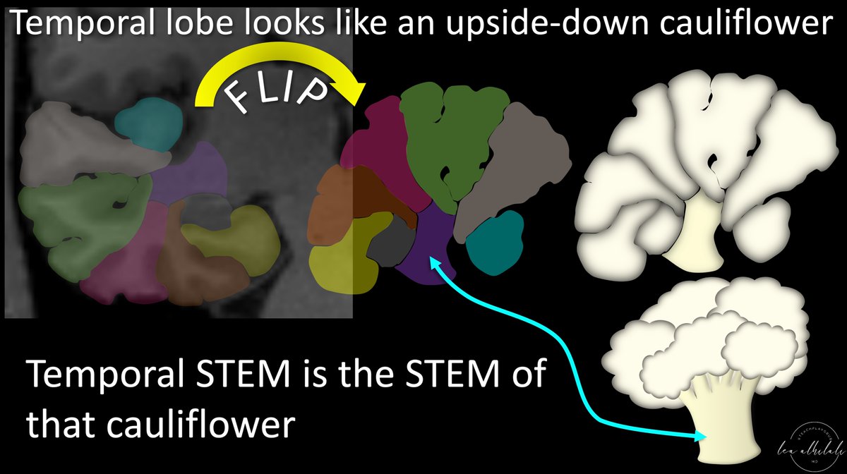 1/Does your ability to remember temporal lobe anatomy seem, well ...