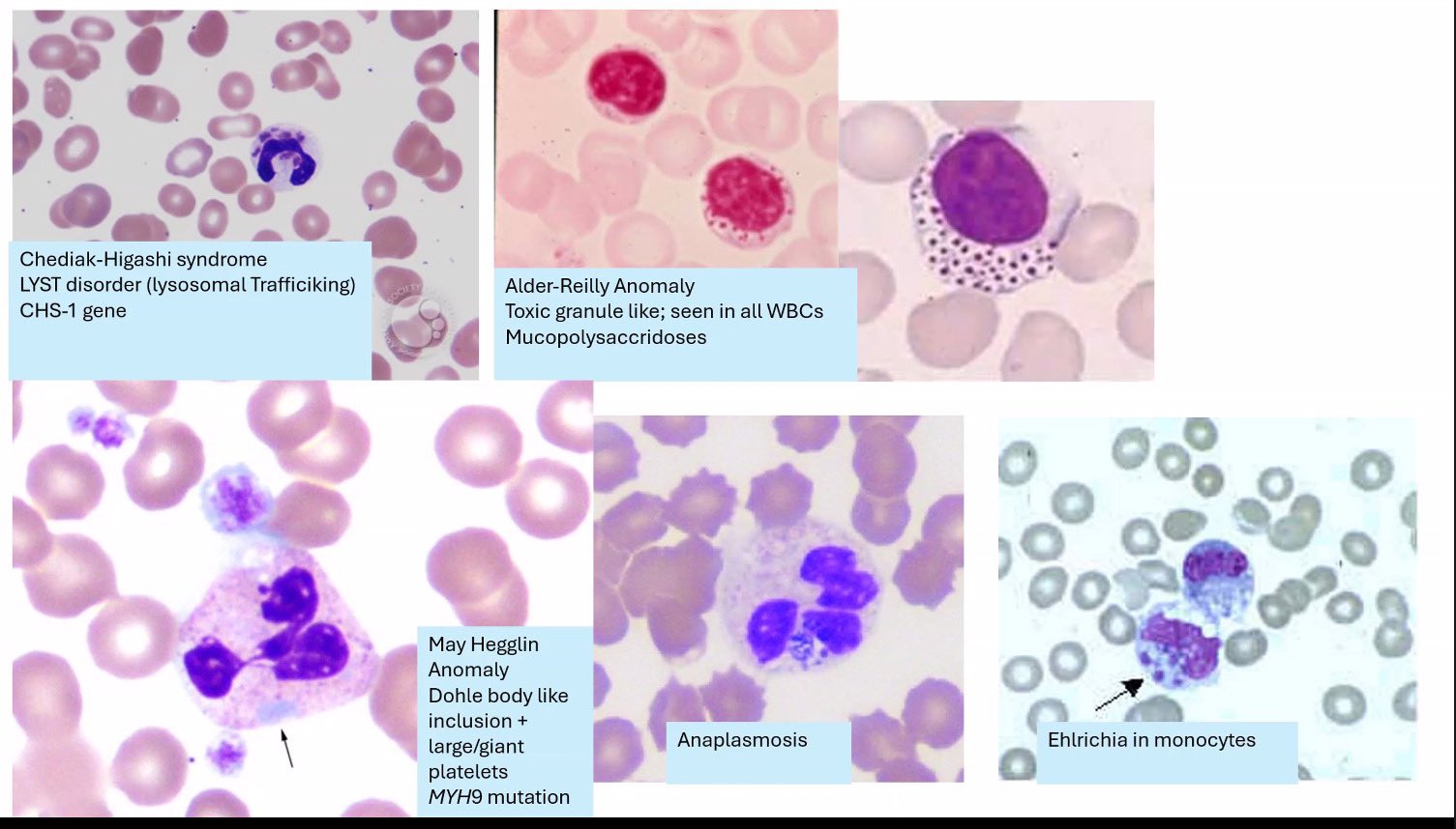 Alder Reilly Anomaly Guide To Paediatric Haematology Morphology 1st