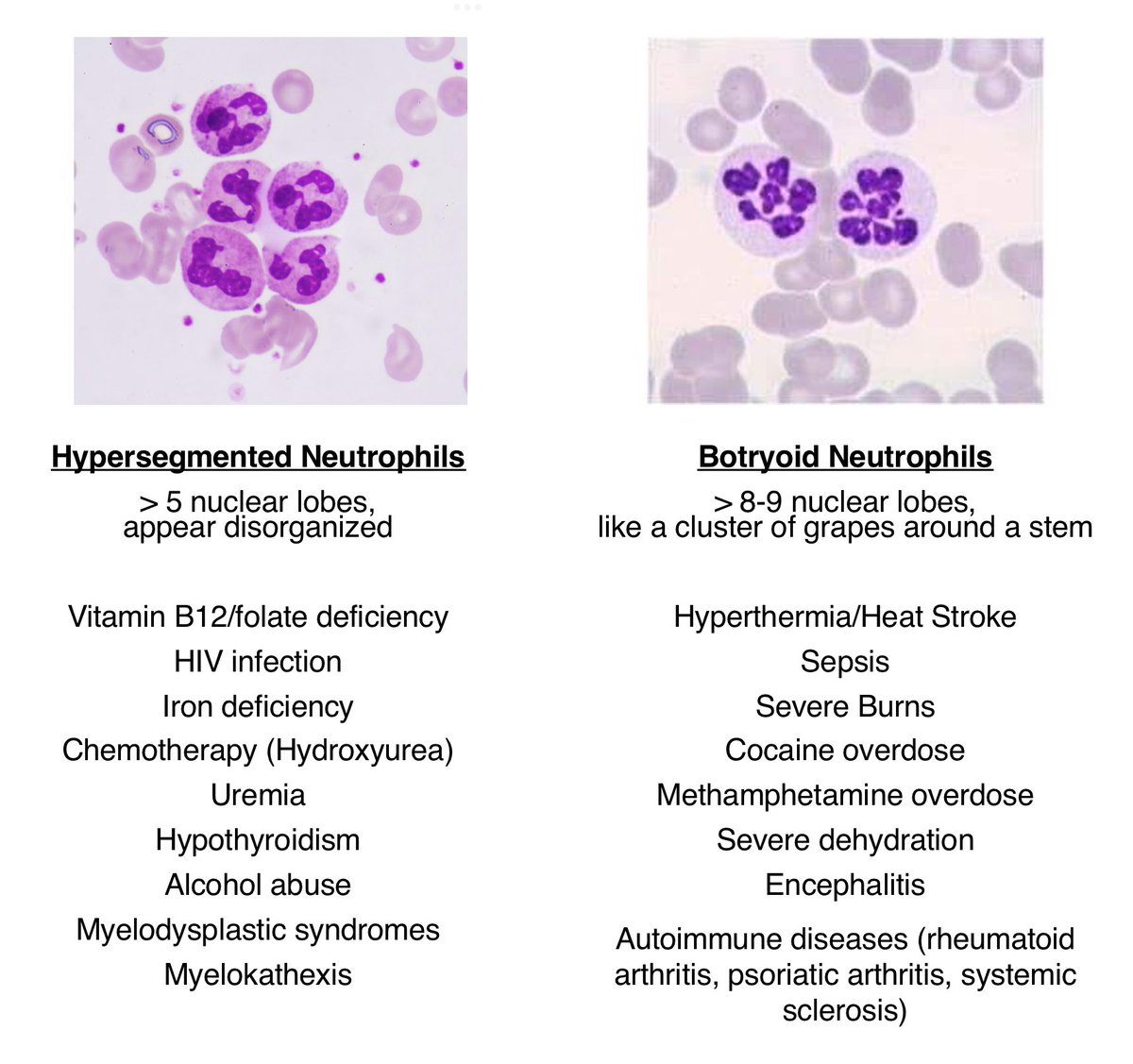 Hypersegmented Neutrophils Criteria