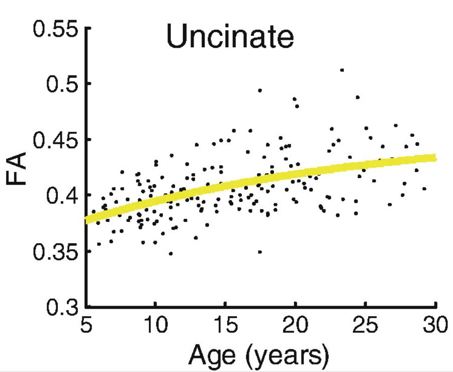 A white matter tract that takes 30 years to mature must be doing ...