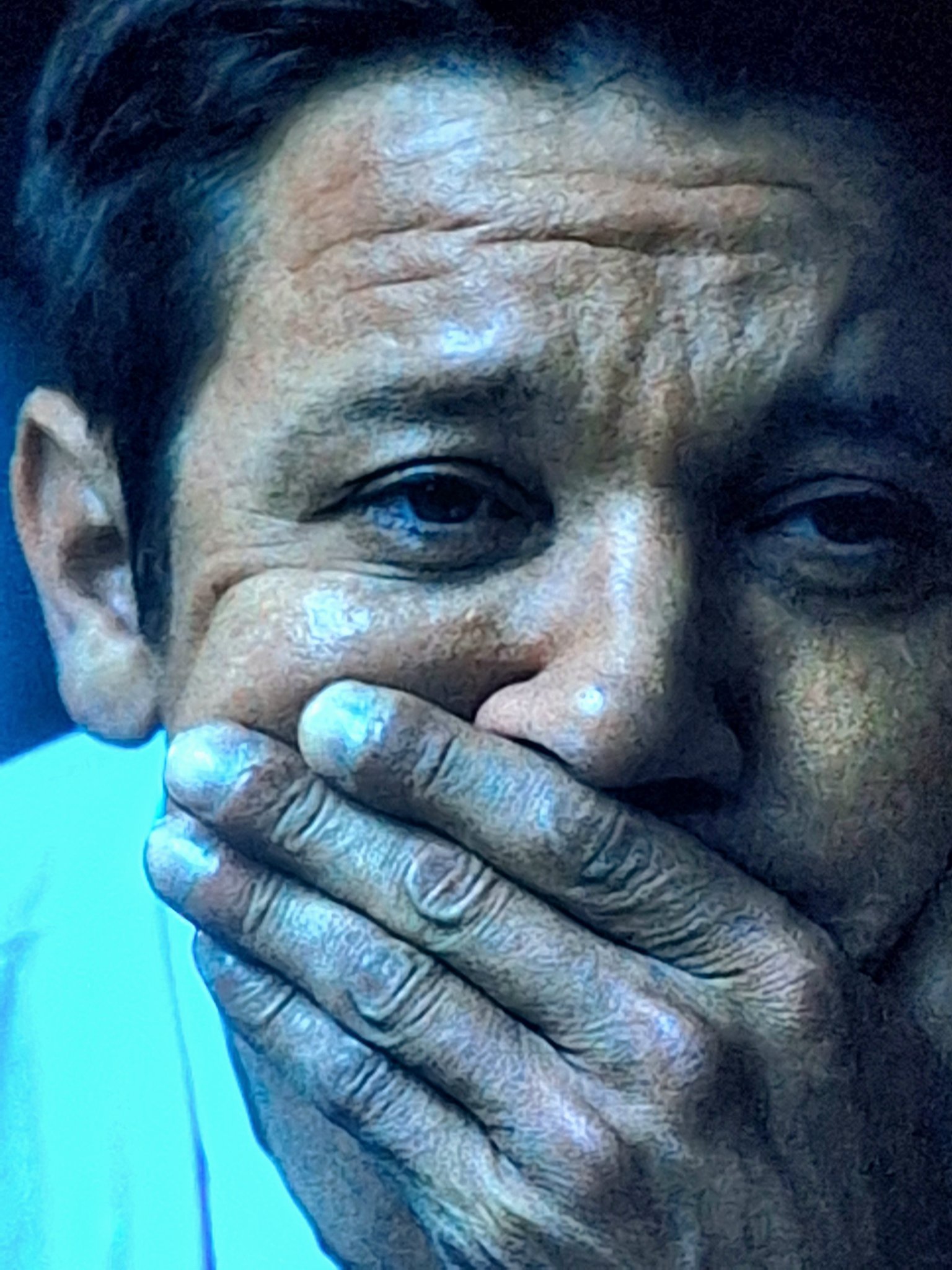 Jeremy Renner Fingernails Thanks, I Hate Clubbed Nails : R/TIHI