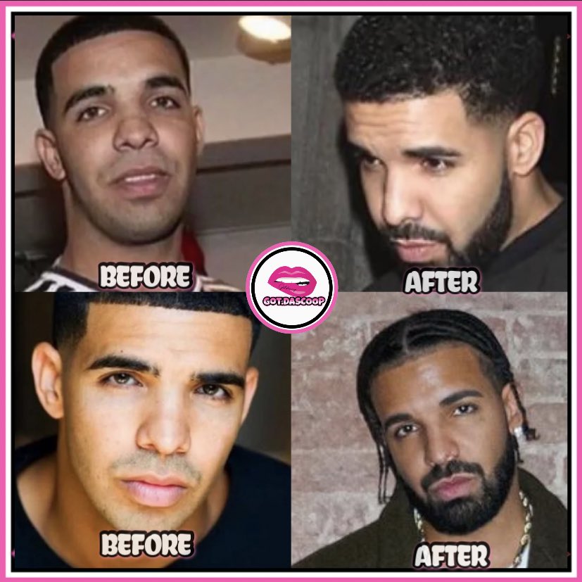 Drake Before And After