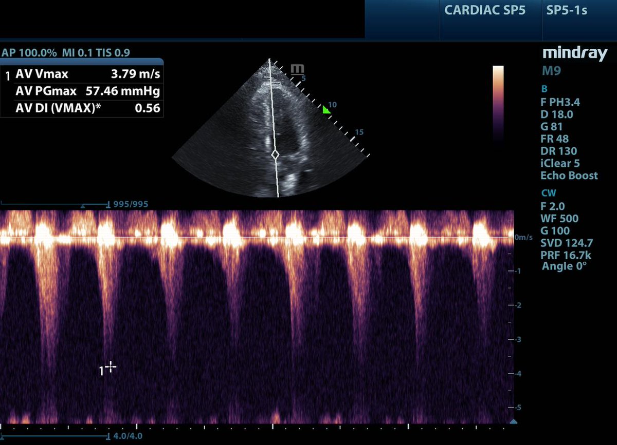 Three acute care medicine 'anti-patterns' (physiological scenarios that ...