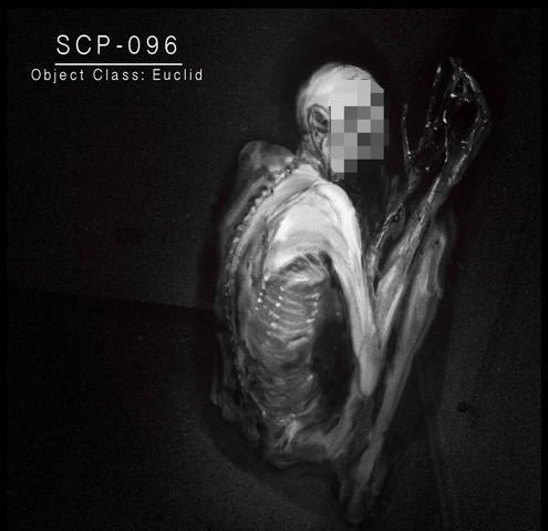 Scp 096 In Real Life