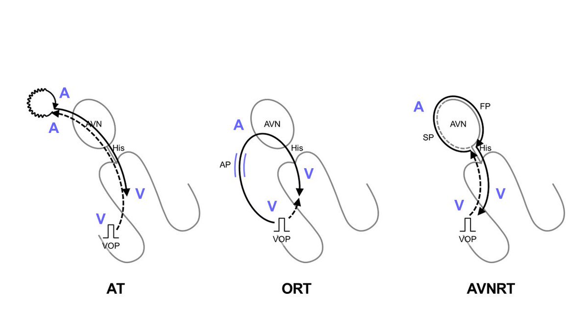 Thread by @Koichi16423232 on Thread Reader App – Thread Reader App