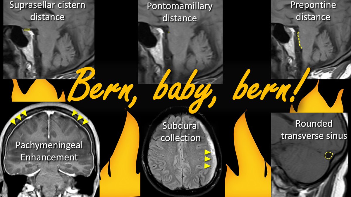 1/CSF leaks are controversial! Some say they're overdiagnosed, others ...