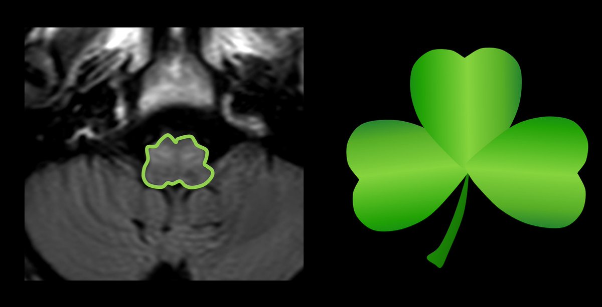 Lea Alhilali, MD's Threads – Thread Reader App