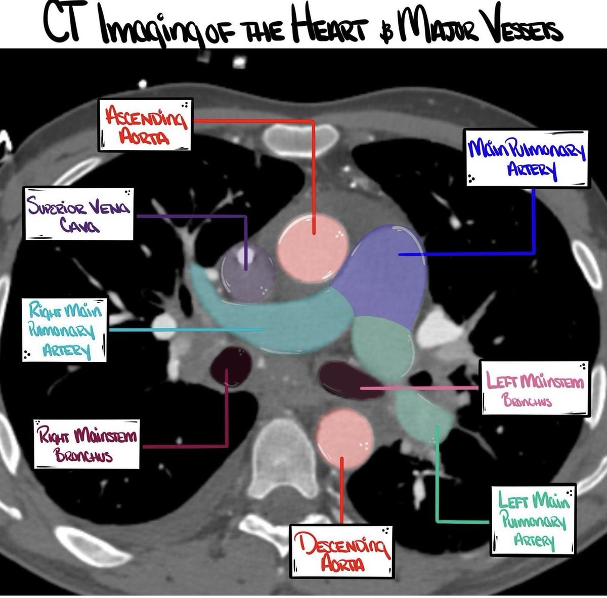 Ct Cardiac Anatomy Oren Gottfried, MD On X: "CT Anatomy Heart And
