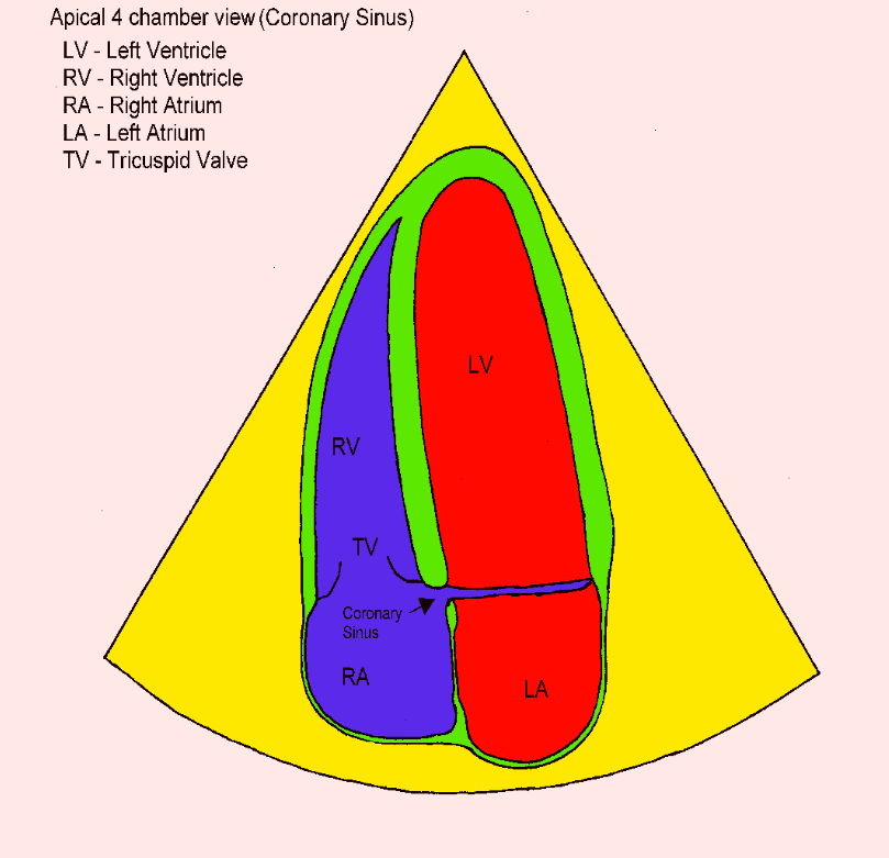 Cardiac #POCUS drawings full version. Click to enlarge/clearer labels ...