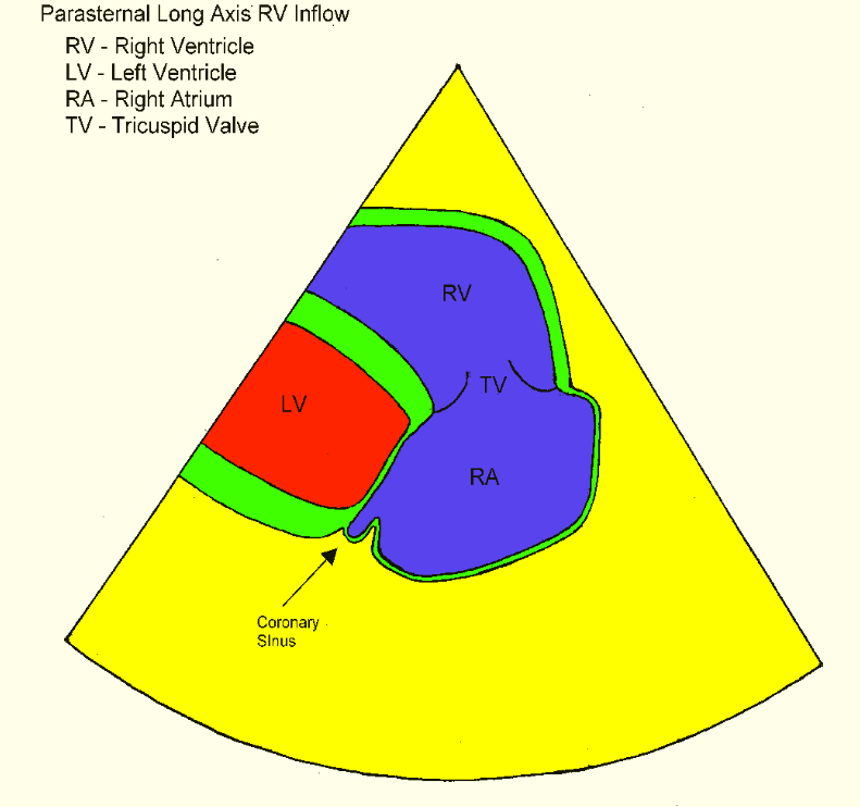 Cardiac #POCUS drawings full version. Click to enlarge/clearer labels ...
