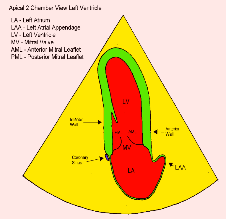 Cardiac #POCUS drawings full version. Click to enlarge/clearer labels ...