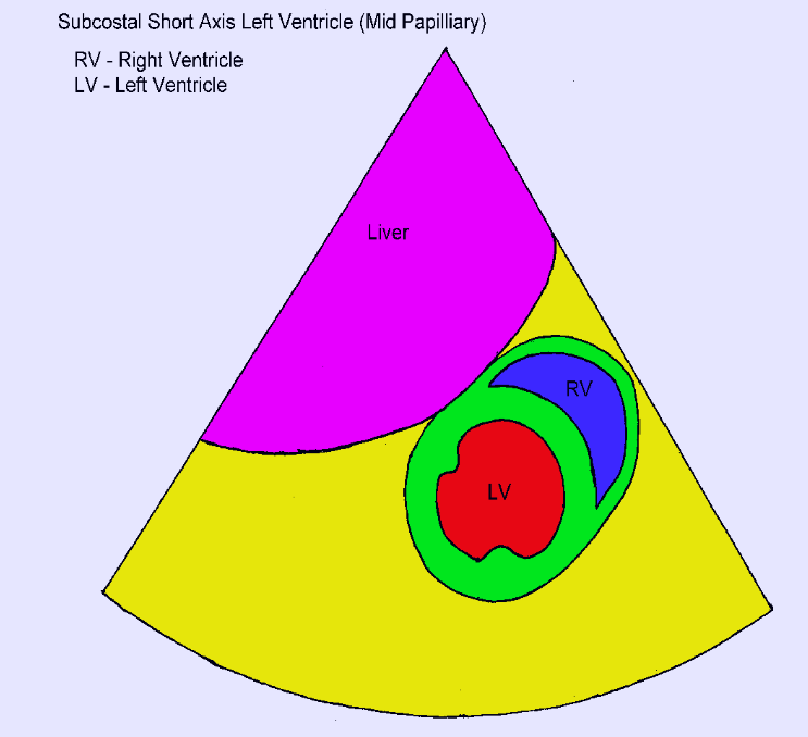 Cardiac #POCUS drawings full version. Click to enlarge/clearer labels ...
