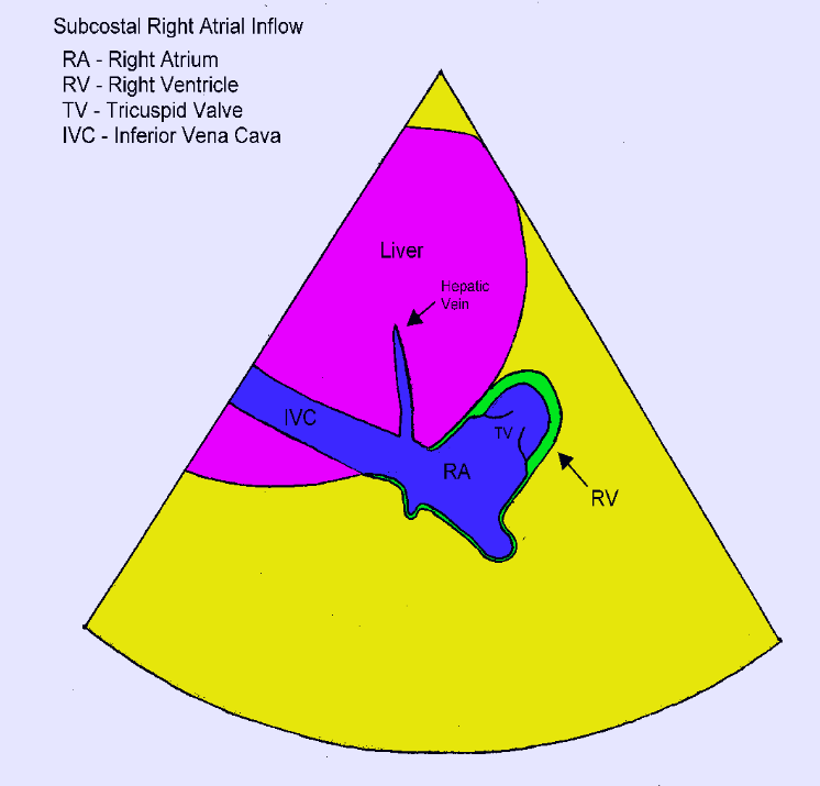 Cardiac #POCUS drawings full version. Click to enlarge/clearer labels ...
