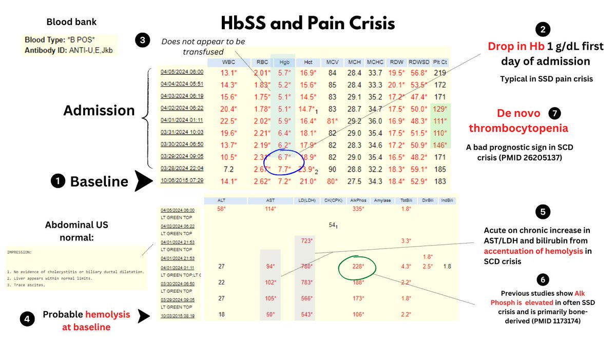 1/5 SCD PAIN CRISIS I posted a series of labs on a patient and asked ...