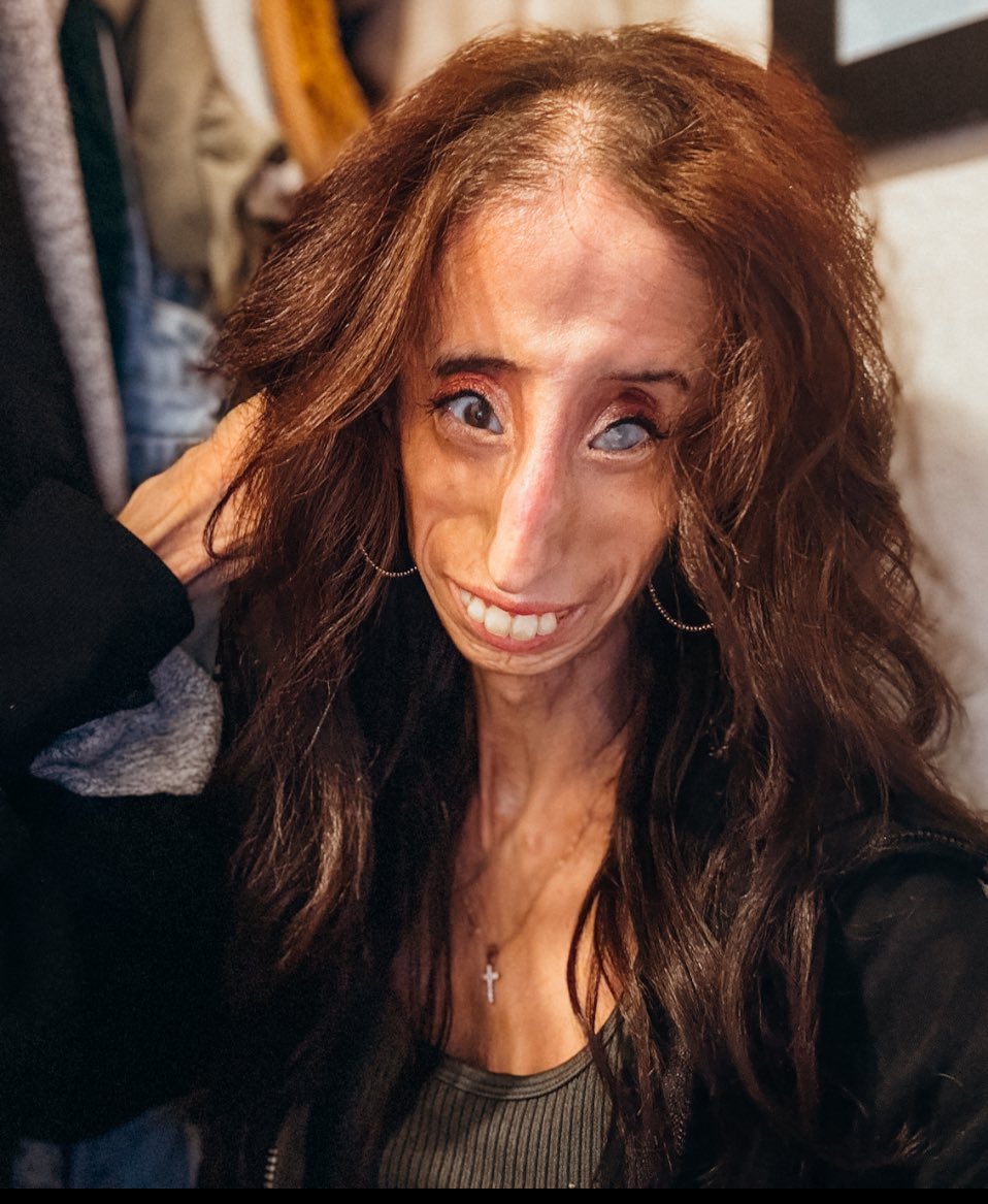 Lizzie Velasquez's Instagram, Twitter & Facebook on IDCrawl
