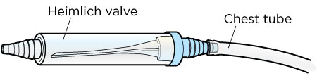 Quick, basic primer🧵- Decompressing a tension pneumothorax A tension ...