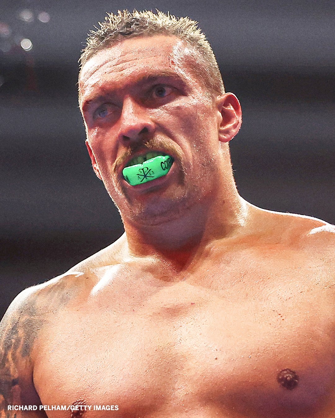 Ufc Broken Jaw