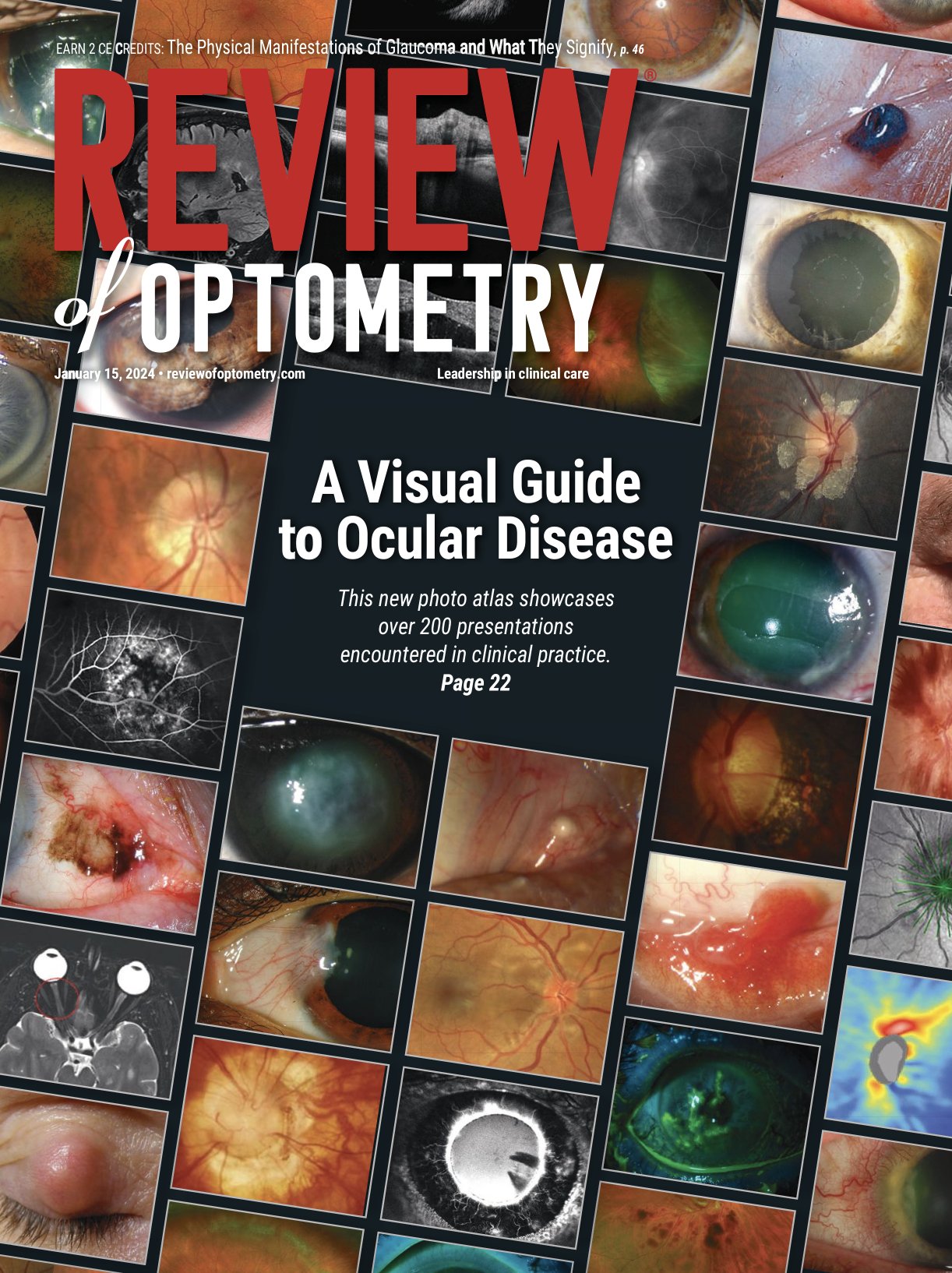 Review Of Optometry