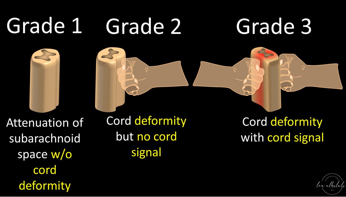 1/Have disagreements between radiologists on the degree of cervical ...