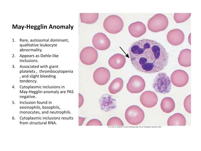 Rare Giant Platelets Explore The Secrets Of The Feathered Edge