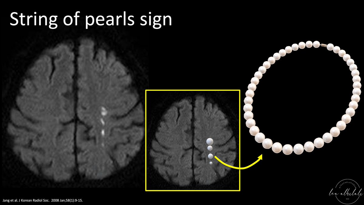 Thread by @teachplaygrub on Thread Reader App – Thread Reader App