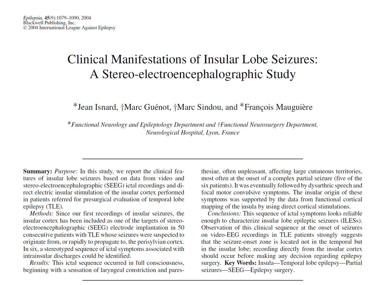 SEIZURE SEMIOLOGY #TWEETORIAL #Epilepsy #Seizure #NeuroX 🧵1/ What is ...