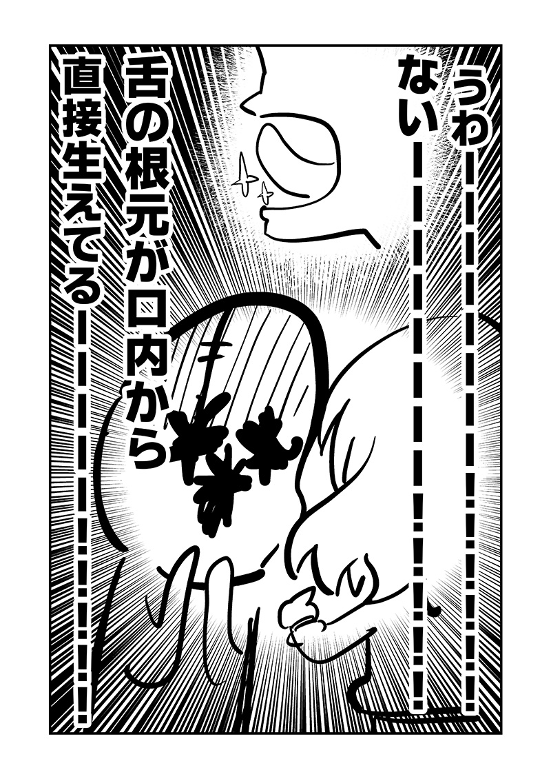 「ベロをレーザーで焼いた話(5/5) 」森キノコ★サンクリ"ア02ab"skeb募集中の漫画