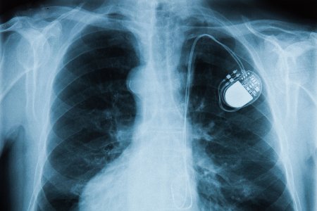 It's named after titans. It's our favourite space age material, used in ...