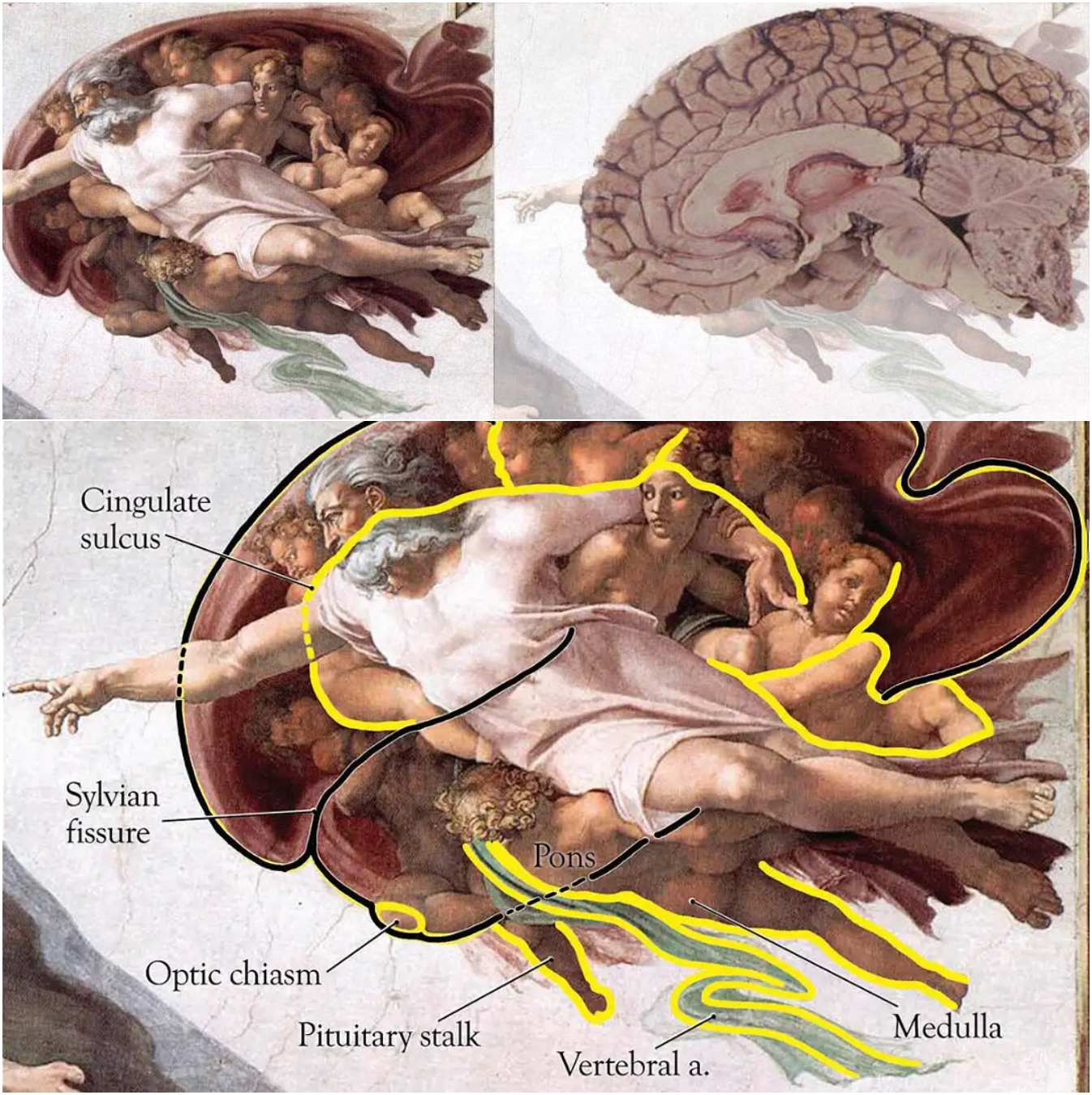 Michelangelo Creation Of Adam Brain