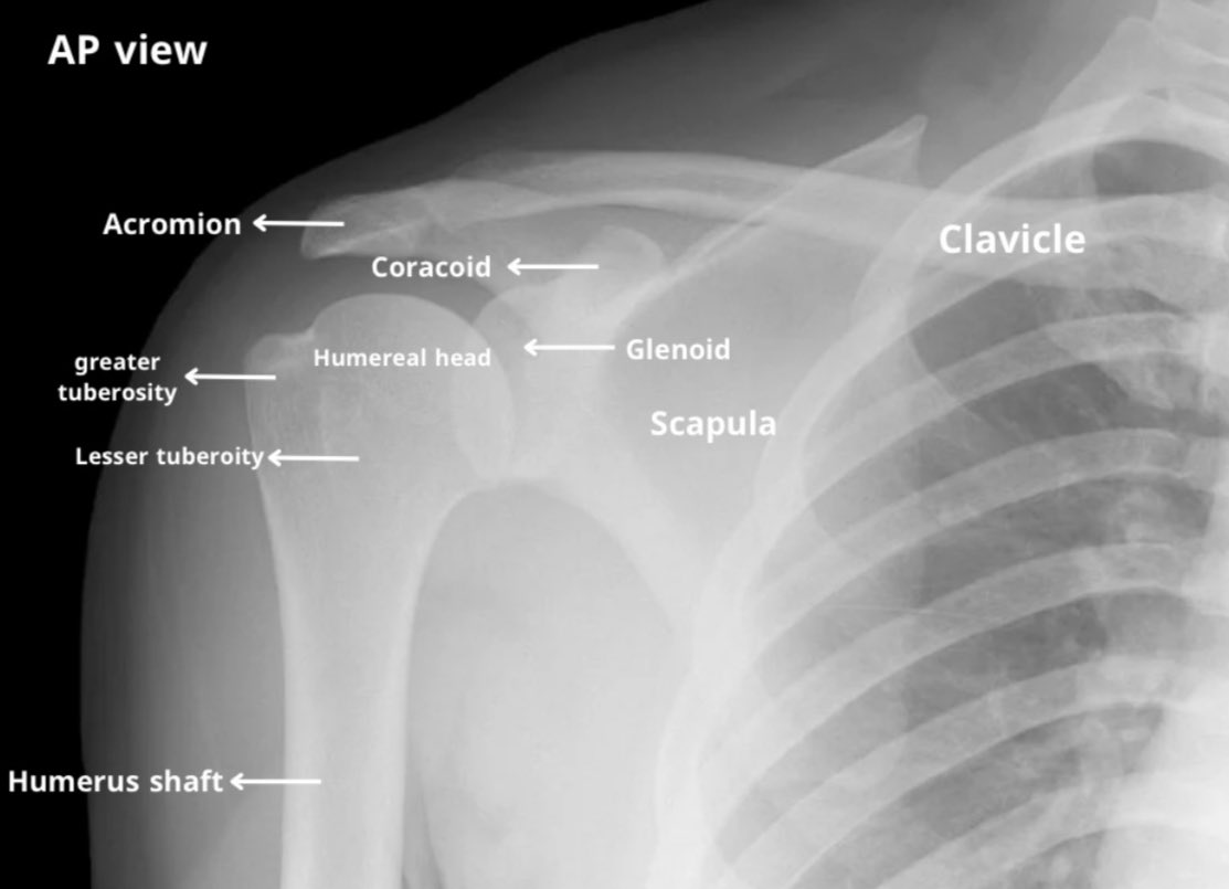 X Ray Shoulder Anatomy 534 Shoulder Xray Stock Photos, High Res