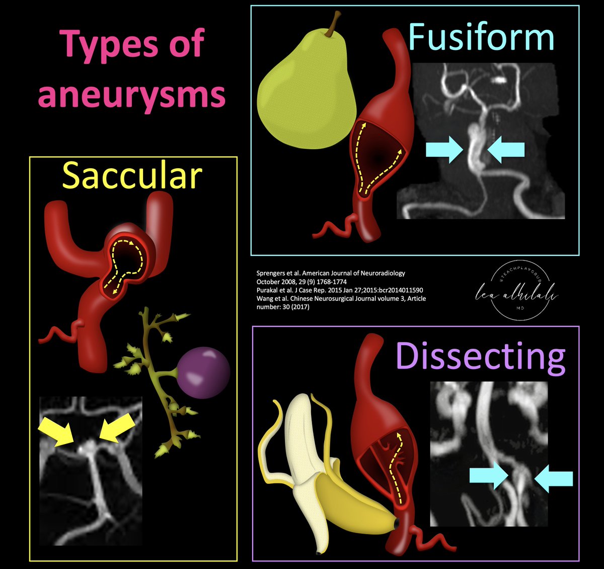 Hungry for an easy way to remember aneurysm types? Here's some FRUIT ...