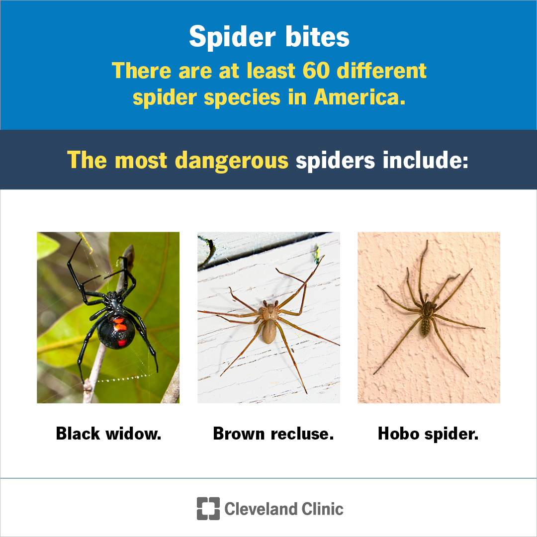 Arachnid Bites Is This Annular Lesion A Spider Bite? | Consultant360